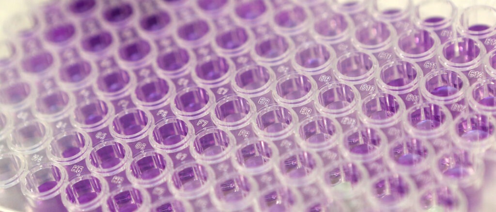 Avacta Group agreement with Astrea Bioseparations ‘the perfect deal ...